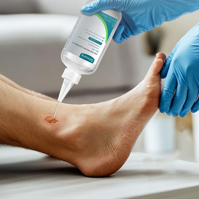 From Hospital to Home_ Dimora PHMB Skin and Wound Cleanser Elevates ...